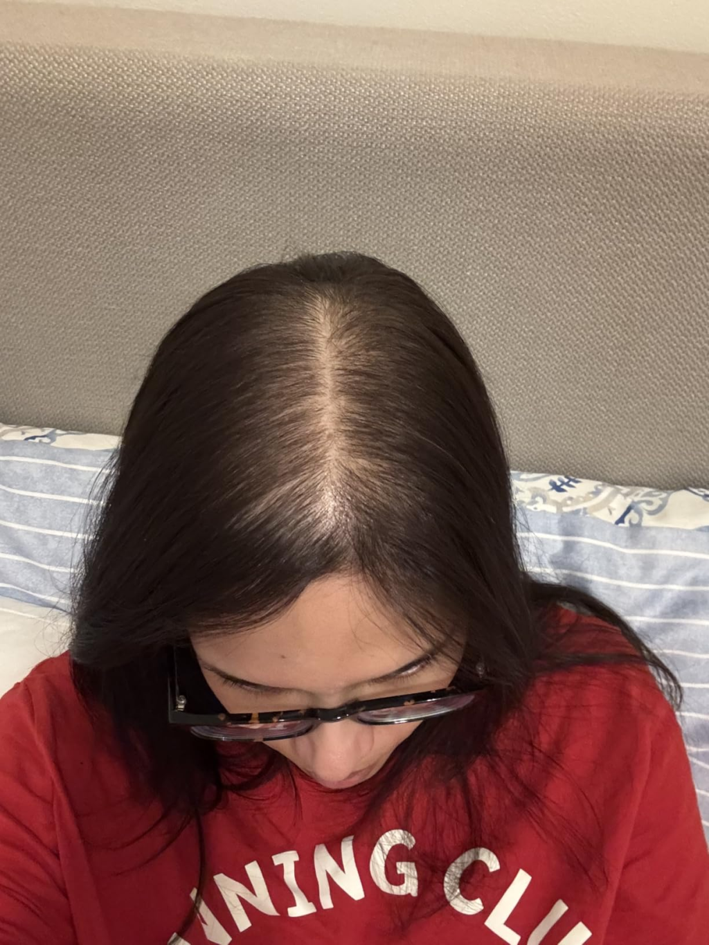 I Tried Force Factor Hair Growth Accelerator — Here’s My Honest Results ...